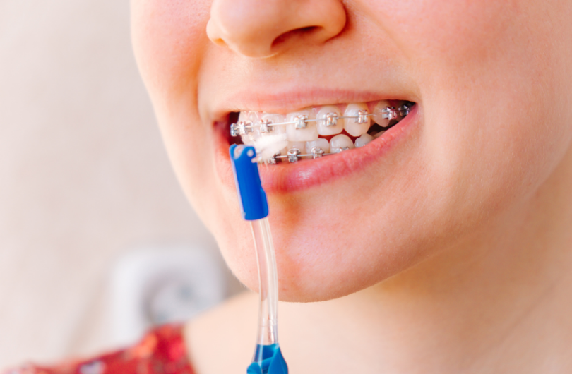 How to Care for Braces | First Impressions Orthodontics